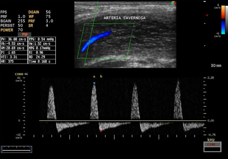 Eco-color-Doppler arterioso e venoso – Radiologia napoli Centro Augusto